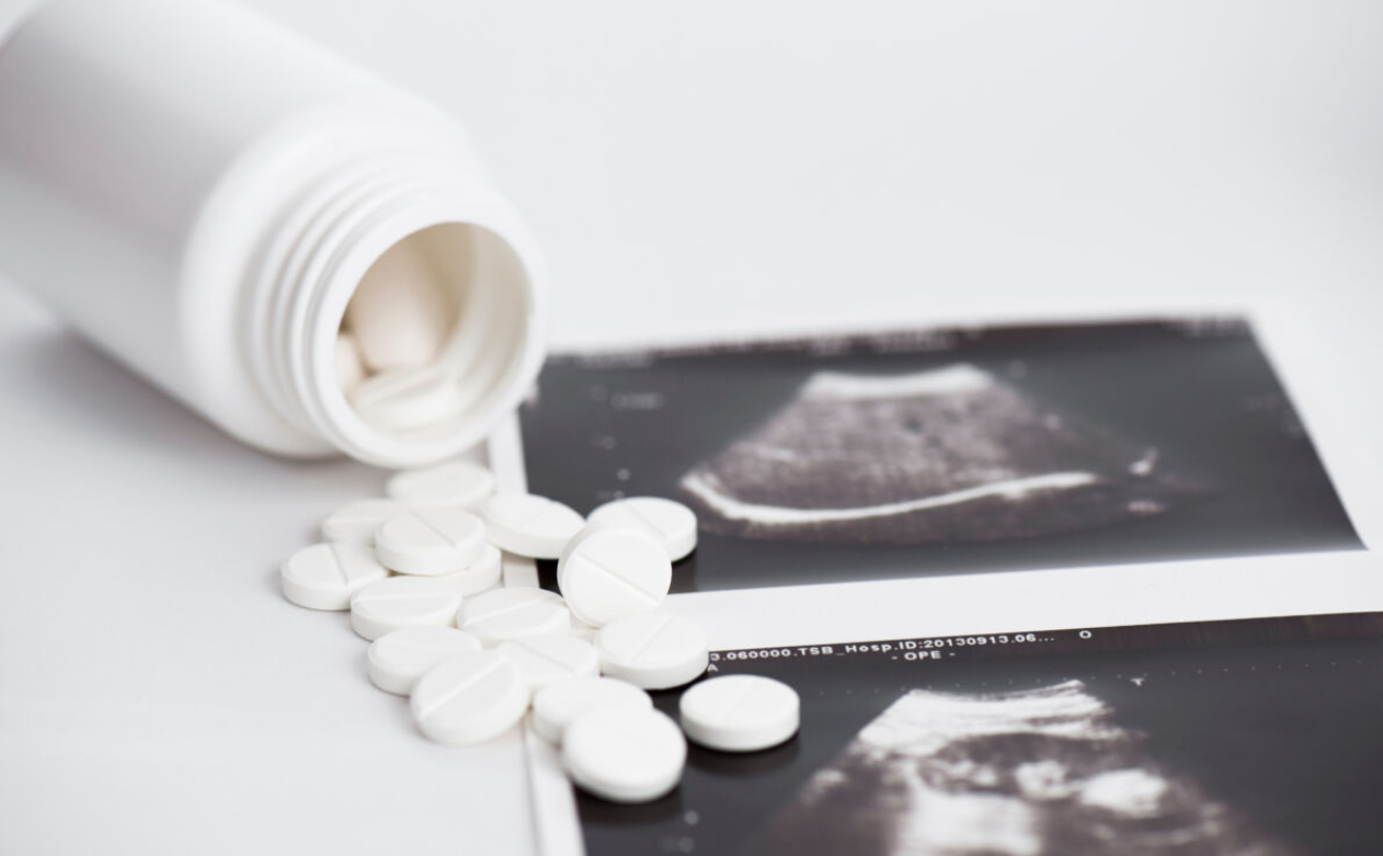 OP-ED: NC law Being Circumvented with Risky Abortion-Pill Scheme - nc ...